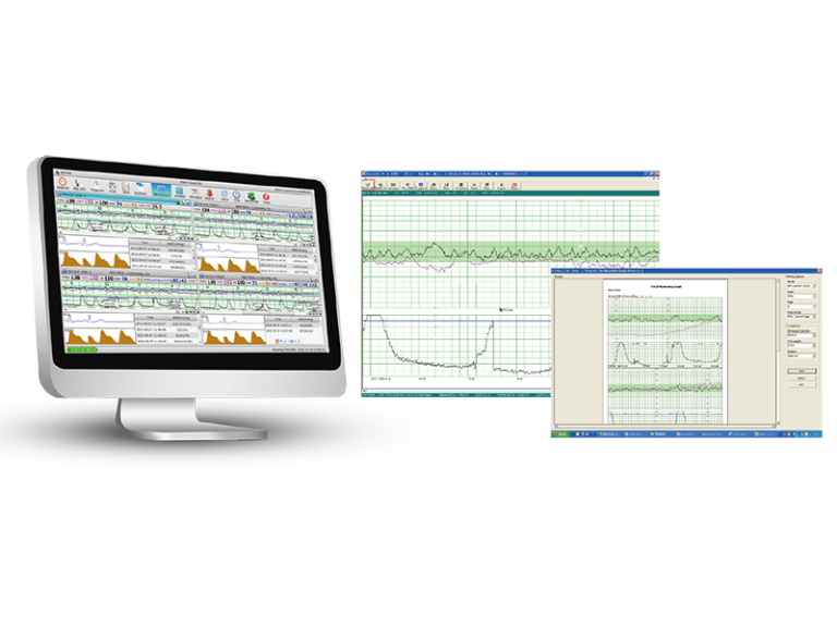 Edan F3 Fetal Monitor | Sains Medika Sdn Bhd