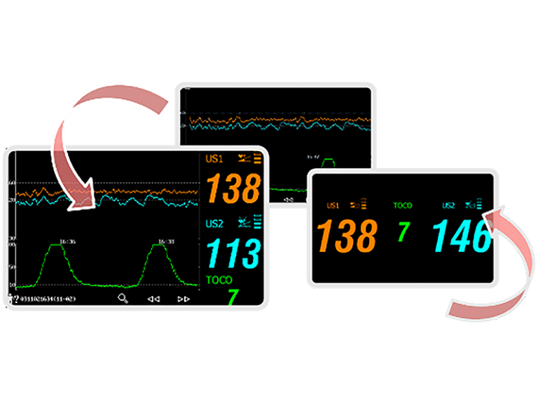 Edan F3 Fetal Monitor | Sains Medika Sdn Bhd