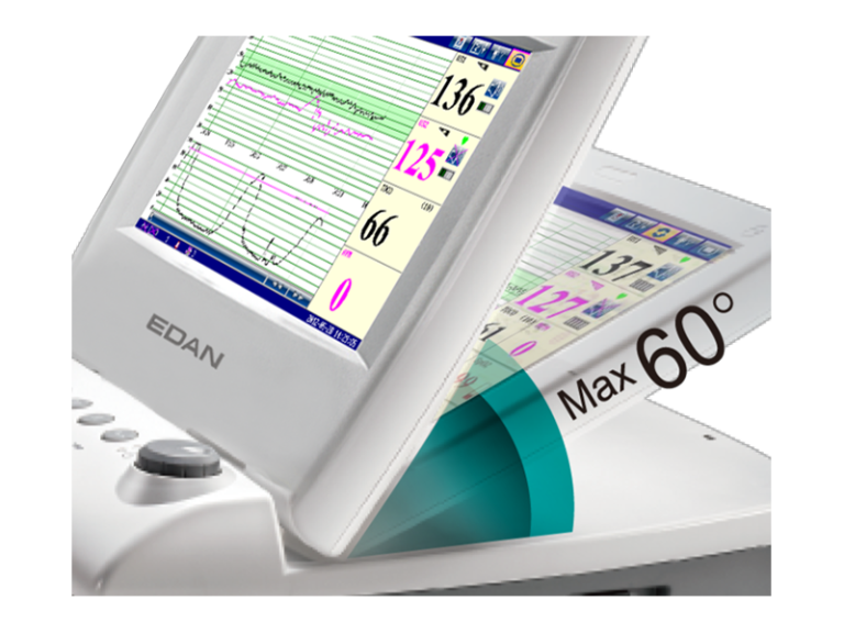 Edan F6 Fetal & Maternal Monitor | Sains Medika Sdn Bhd
