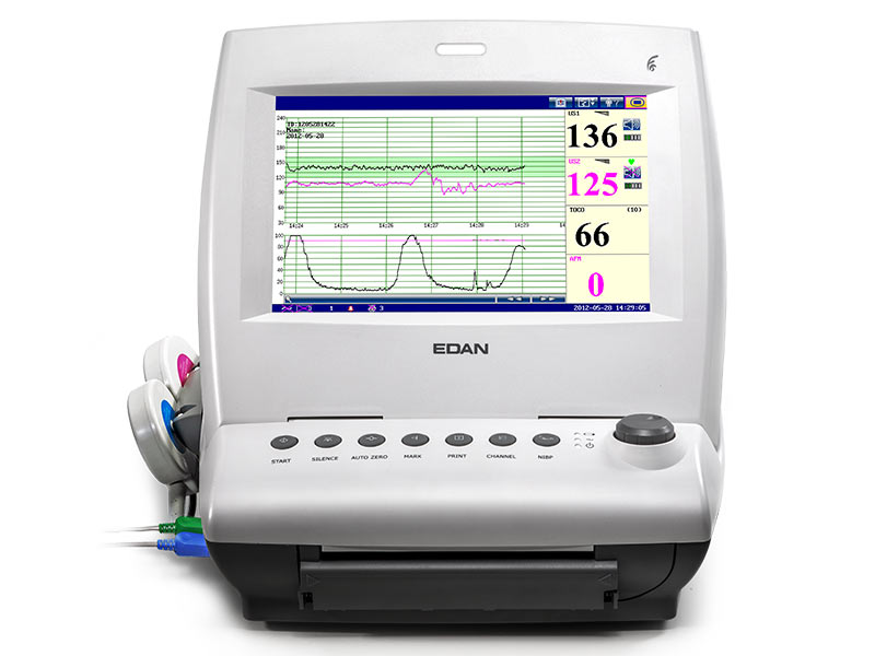 OB&GYN | Sains Medika Sdn Bhd