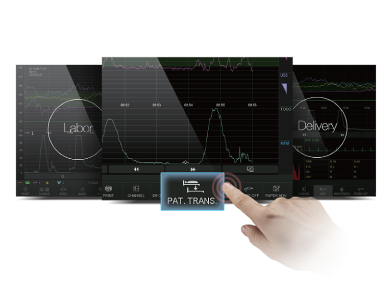 Edan F15 Fetal & Maternal Monitor | Sains Medika Sdn Bhd