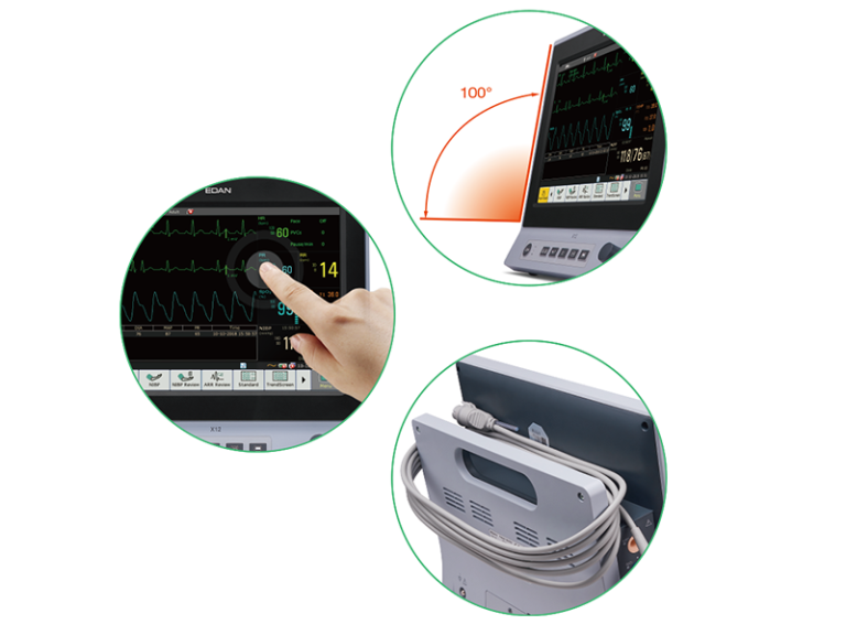 Edan X Series Patient Monitor | Sains Medika Sdn Bhd