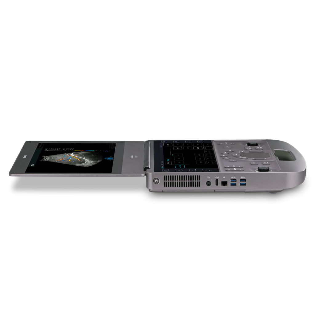 Edan Acclarix AX8 Diagnostic Ultrasound System | Sains Medika Sdn Bhd