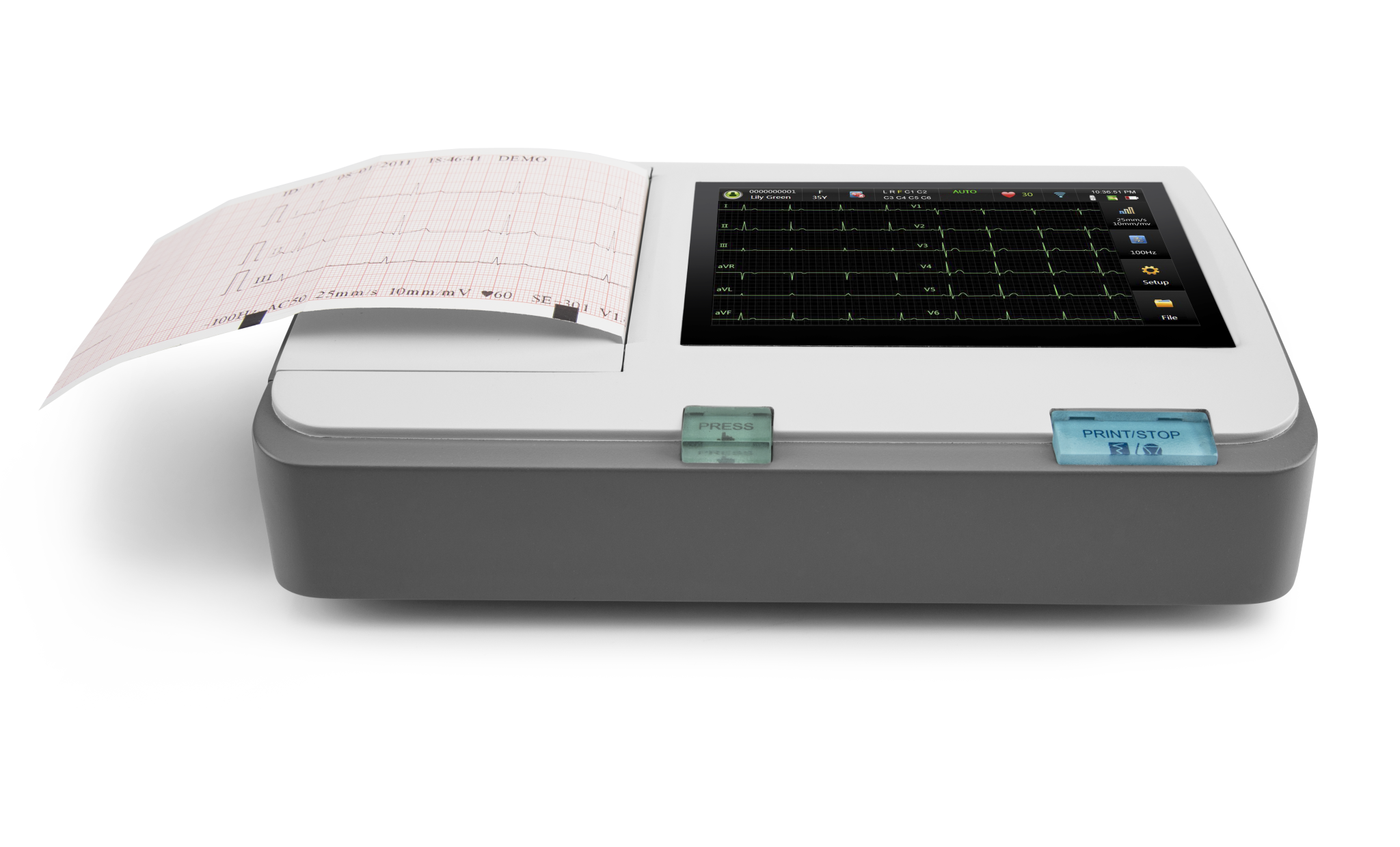 Diagnostic ECG | Sains Medika Sdn Bhd
